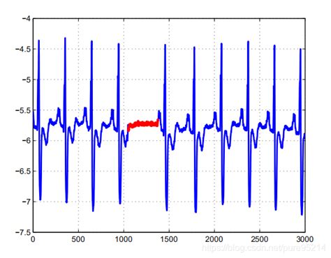 异常检测anomaly Detection（一）定义、分类及方法 Csdn博客