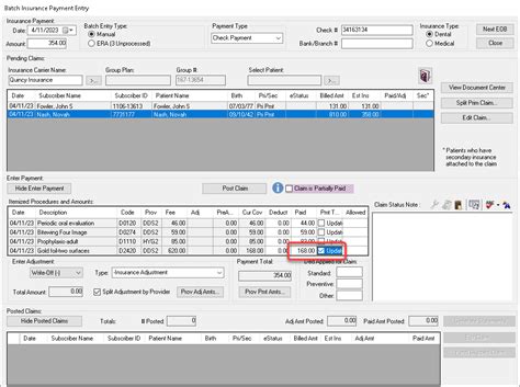 What is the Payment Table and How Can I Update It? | The Dentrix Blog