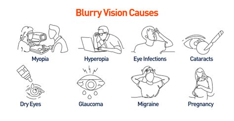Blurry Vision Symptoms Causes Diagnosis And Effective Treatment Options