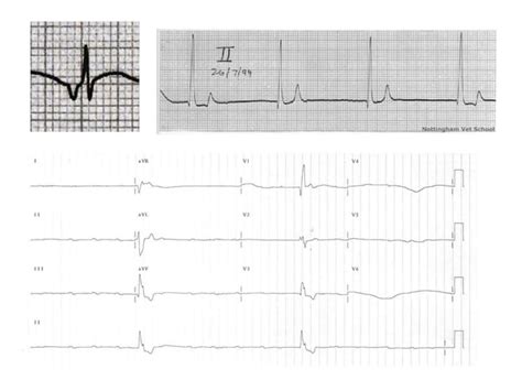 Ecg Lecture Sinus Arrest Sinoatrial Exit Block Av Block And Escape Rhythms Ppt Heart And