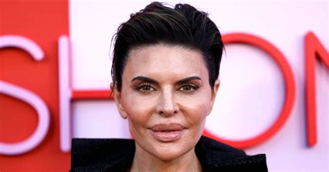 Lisa Rinna Reacts To Criticism Of Excessive Face Filler