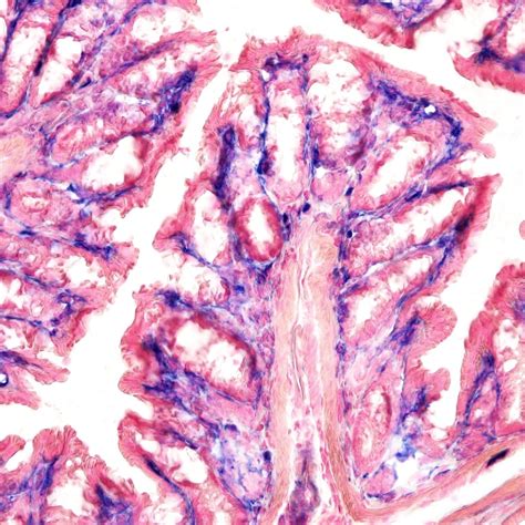Solarbio 알칼리성 포스파타제 염색 키트 아조염료 얼룩 Dna 테스트 전문가
