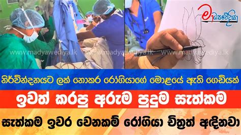 සැත්කම ඉවර වෙනකම් චිත්‍ර ඇඳපු රෝගියා Youtube