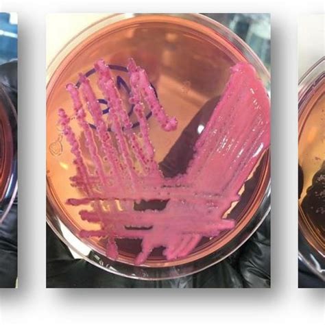 Colonies Of Gram Negative Bacterial Isolate On Macconkey Agar