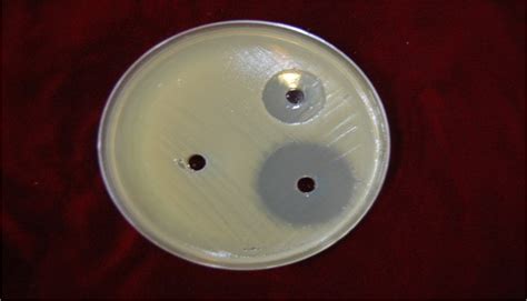 Inhibition Zone Mm Of Methanolic Bark Extract Of Juglans Regia