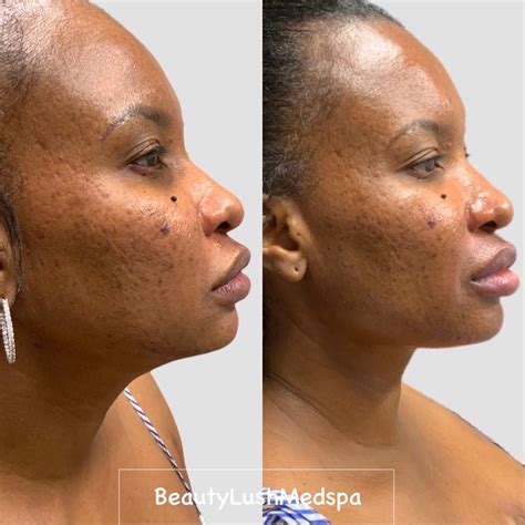 BEAUTY LUSH MEDSPA Updated May 2025 30 Photos 201 N University Dr