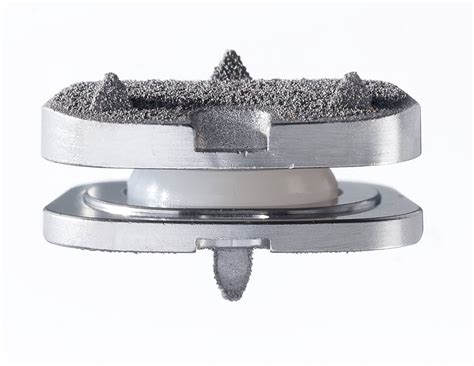 Disco Intervertebral Degenerative Disc Disease Causes And Treatment