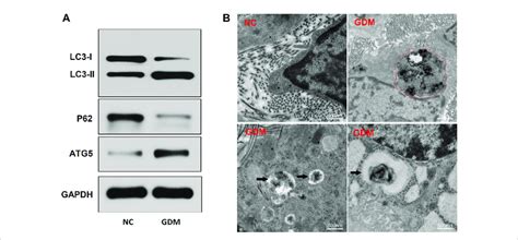 Placenta Autophagy Related Protein Expression And Ultrastructure In Ncs