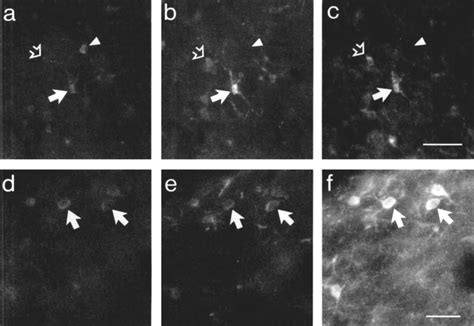 Photomicrographs Of Striatonigral Projection Neurons Containing Both Ss