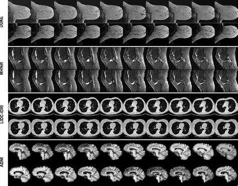 Figure 1 From Medical Diffusion Denoising Diffusion Probabilistic