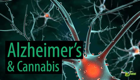 Reducing Beta-Amyloid Buildup With Medical Marijuana