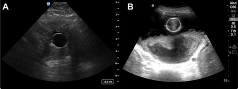 Genitourinary Ultrasound Emergency Medicine Clinics