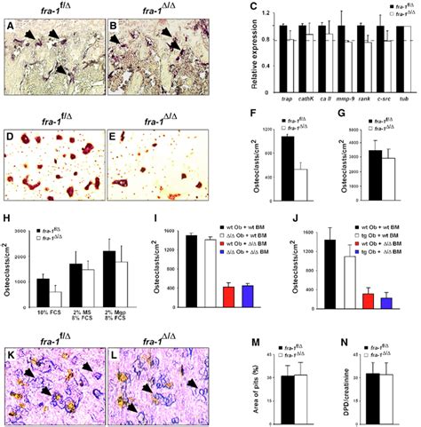 The Fos‐related Antigen Fra‐1 Is An Activator Of Bone Matrix Formation The Embo Journal