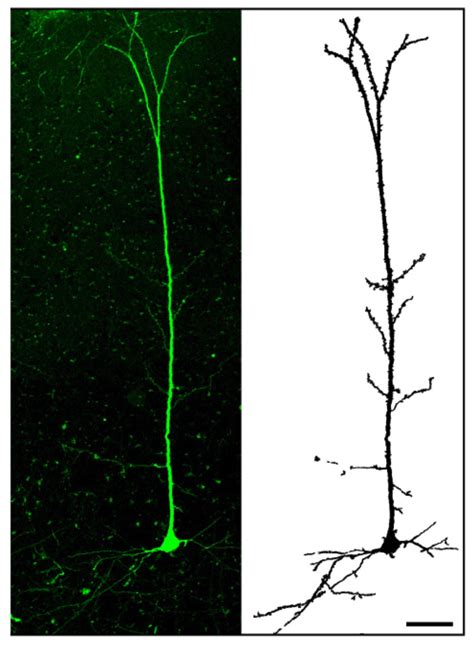 Scientists Repair Damaged Brain Tissue
