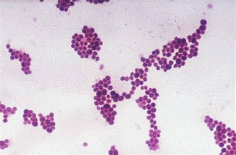 6 Gram Stain Of Saureus Download Scientific Diagram