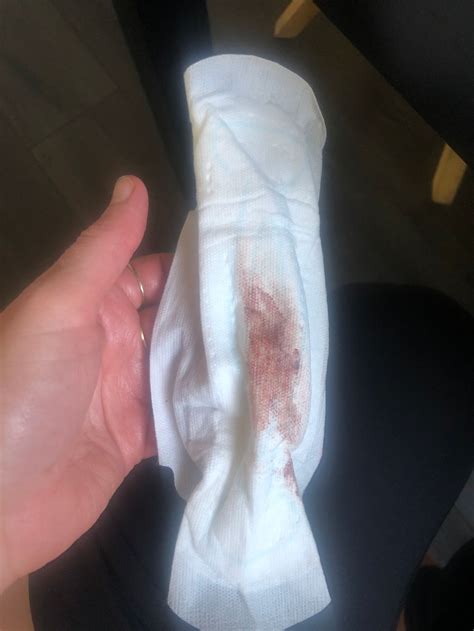 Normal Spotting Vs Miscarriage