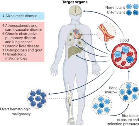 Clonal Hematopoiesis Aging And Alzheimers Disease Nature Medicine