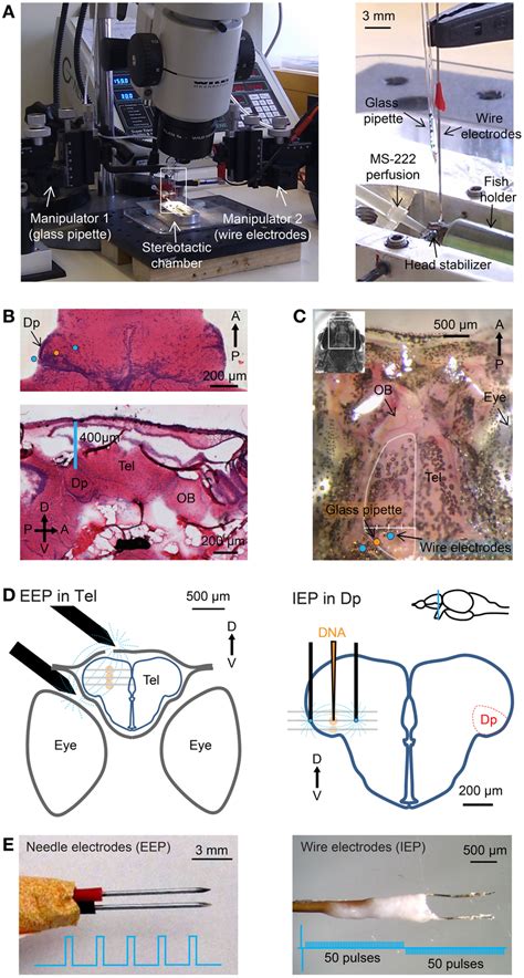 Stereotactic Injection And Electroporation A Left Apparatus For Download Scientific Diagram