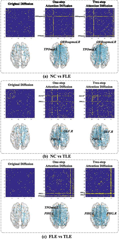 Figure 1 From Attention Diffusion Bilinear Neural Network For Brain Network Analysis Semantic