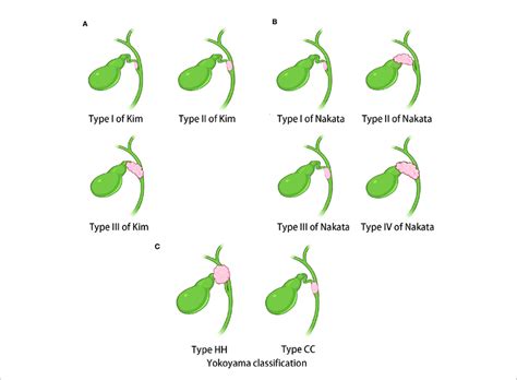 Sketches Of The Existing Classifications Of Cdc A Kims
