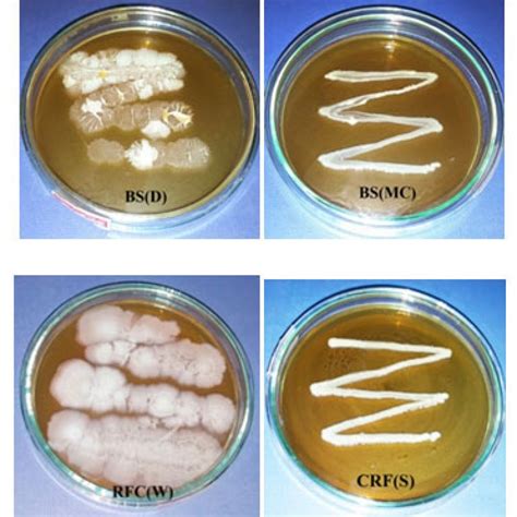 Screening For Isolation Of Succinic Acid Producing Microbes