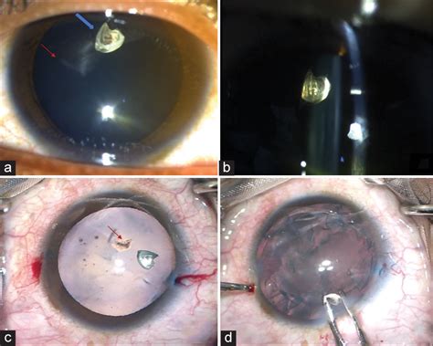Journal Of Ophthalmic Research And Practice Home