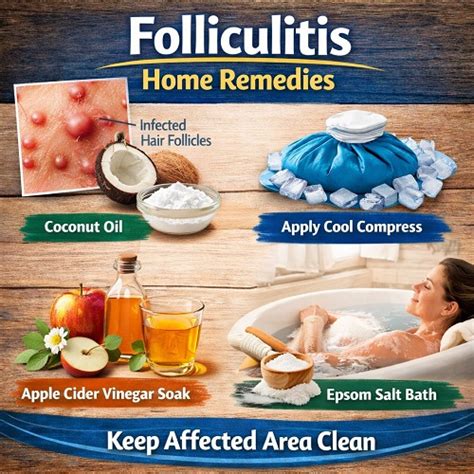 Effective Folliculitis Home Remedies For Fast Relief And Healing