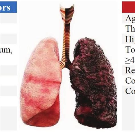 Figure1 Preventive And Risk Factors Of Bleomycin Induced Lung Injury