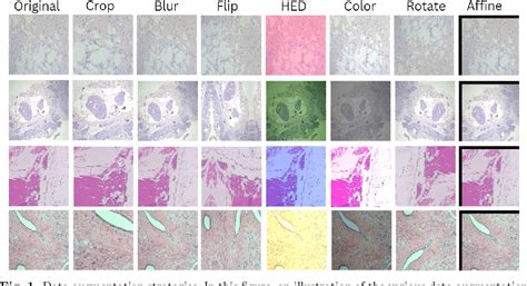 Figure 1 From Classification Of Breast Cancer Histopathology Images