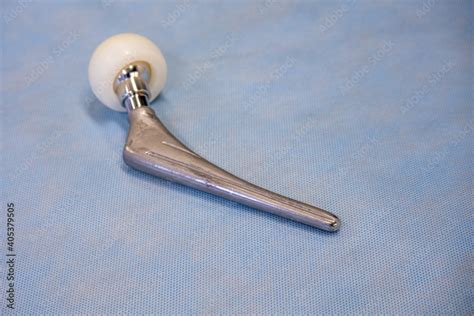 An Explanted Surgical Hip Prosthesis Lies On An Operating Table Stock