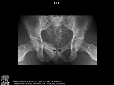 Dean K Matsuda M D Nicole A Matsuda Rachel Head B S Ppt Download