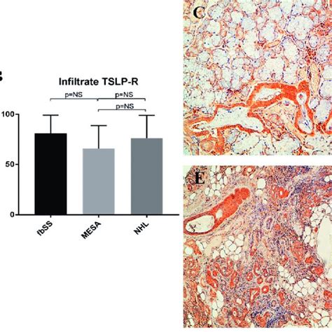 A Negative Control Of Tslp Staining By Immunohistochemistry In