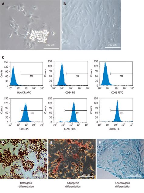 Identification Of Nucleus Pulposus Derived Mesenchymal Stem Cells A