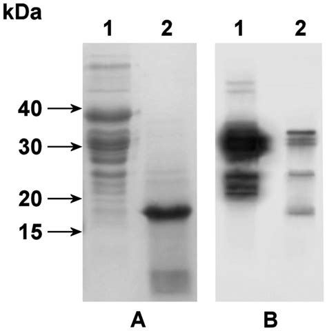 Sds Page And Western Blot Analysis Of The Recombinant Purified Proteins