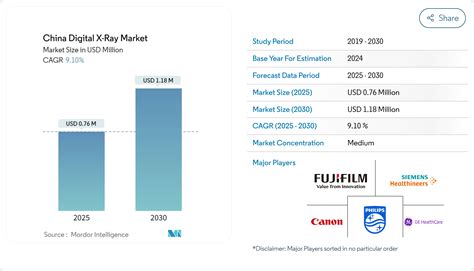중국 디지털 X Ray 시장 규모 점유율 및 분석