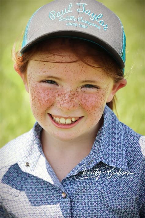 Taches De Rousseur Freckles
