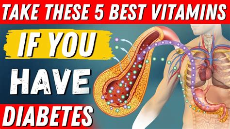 Take These 5 Best Vitamins If You Have Diabetes Diabetes