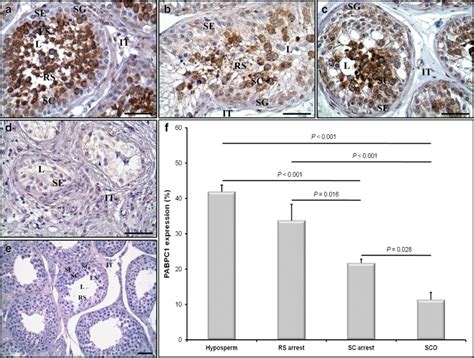 The Polya Binding Protein Genes Epab Pabpc1 And Pabpc3 Are
