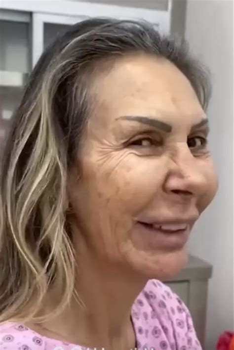 Şarkıcı Petek Dinçöz ün annesi estetik olmuştu Doktoru son halini paylaştı