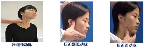 开放性伤口的止血包扎