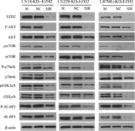 Ezh2 Gene Silencing Attenuated The Expression Of Proteins Involved In