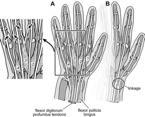Variability In Muscle Insertions And Tendons Of The Hand The Lumbrical