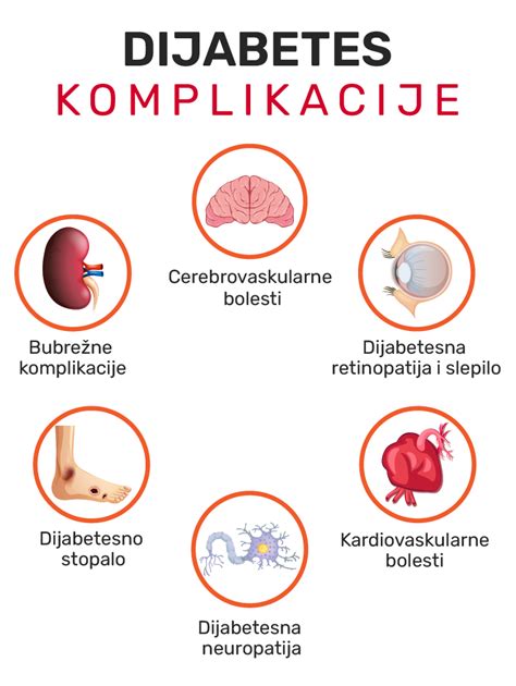 Dijabetes hronična bolest sa ozbiljnim posledicama Miter International