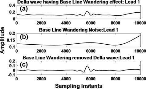 A The Presence Of Baseline Artefact In A Specific EEG Band B The Download Scientific Diagram