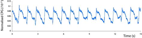 Sample Of The Time Varying Capacitance Plethysmograph Cpg Signal