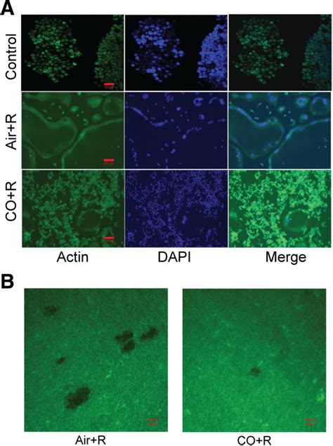Co Inhibits F Actin Ring Formation By Rankl Treated Raw 2647 Cells