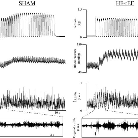 Examples Of Original Tracings Of The Blood Pressure And Integrated