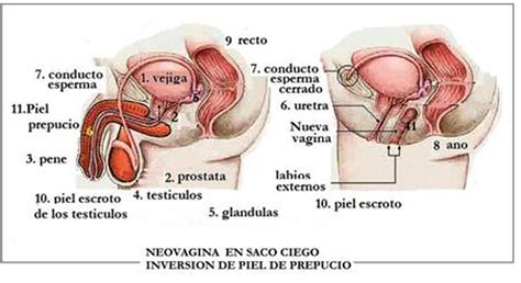 Reafirmación De Género Cómo Son Las Cirugías Que Ayudan A Fortalecer La Identidad Sexual