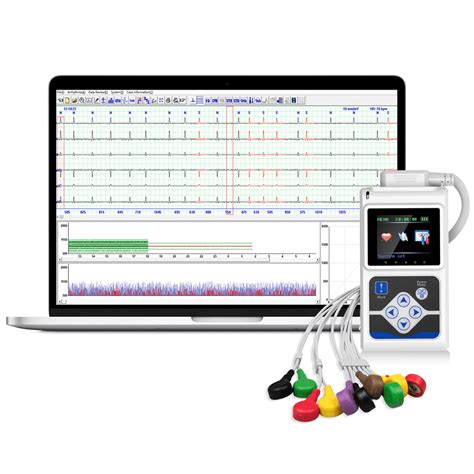 Why Chest Based Electrical Heart Rate Tracking Is More Accurate Than W