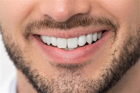 Spaces Between Teeth Newbury Park Dentist
